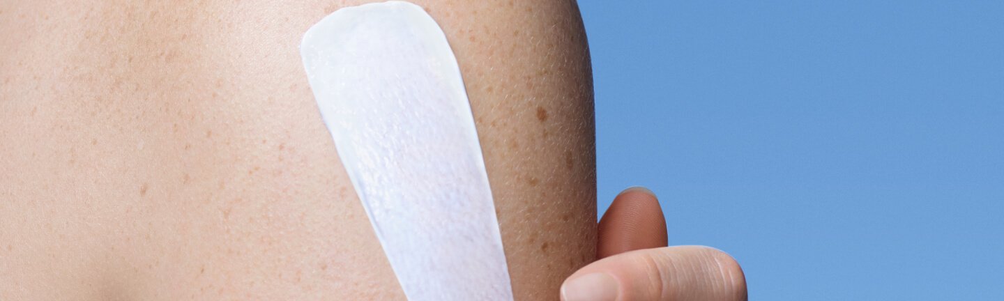 Cosuri pe Spate (Acnee corporala) : Cauze si Solutii Acnee pe spate