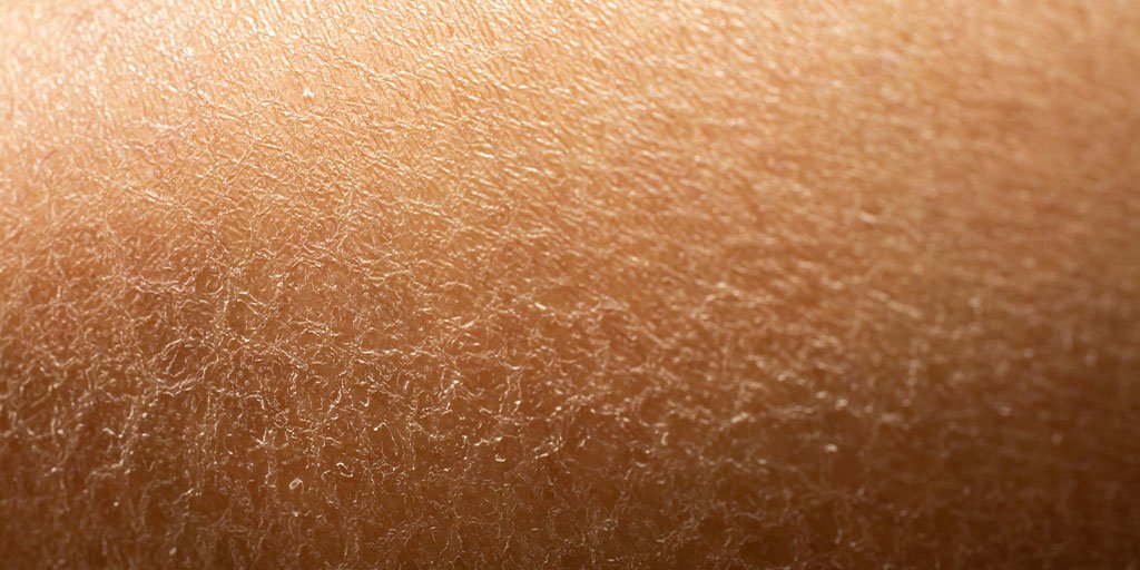 Descuamarea pielii si un ten uscat: cum ingrijiti pielea deshidratata